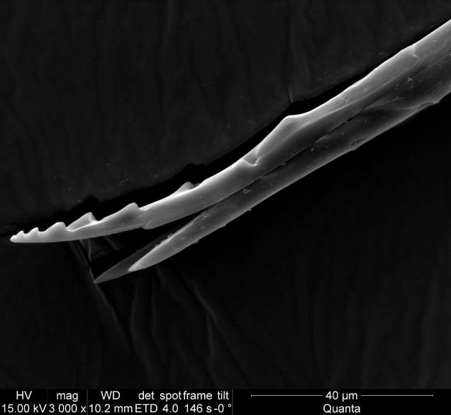 Serrated egg-laying organ gives wasps an edge | Richa Malhotra